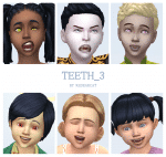 The Best Teeth CC To Have Your Sims Grinning!