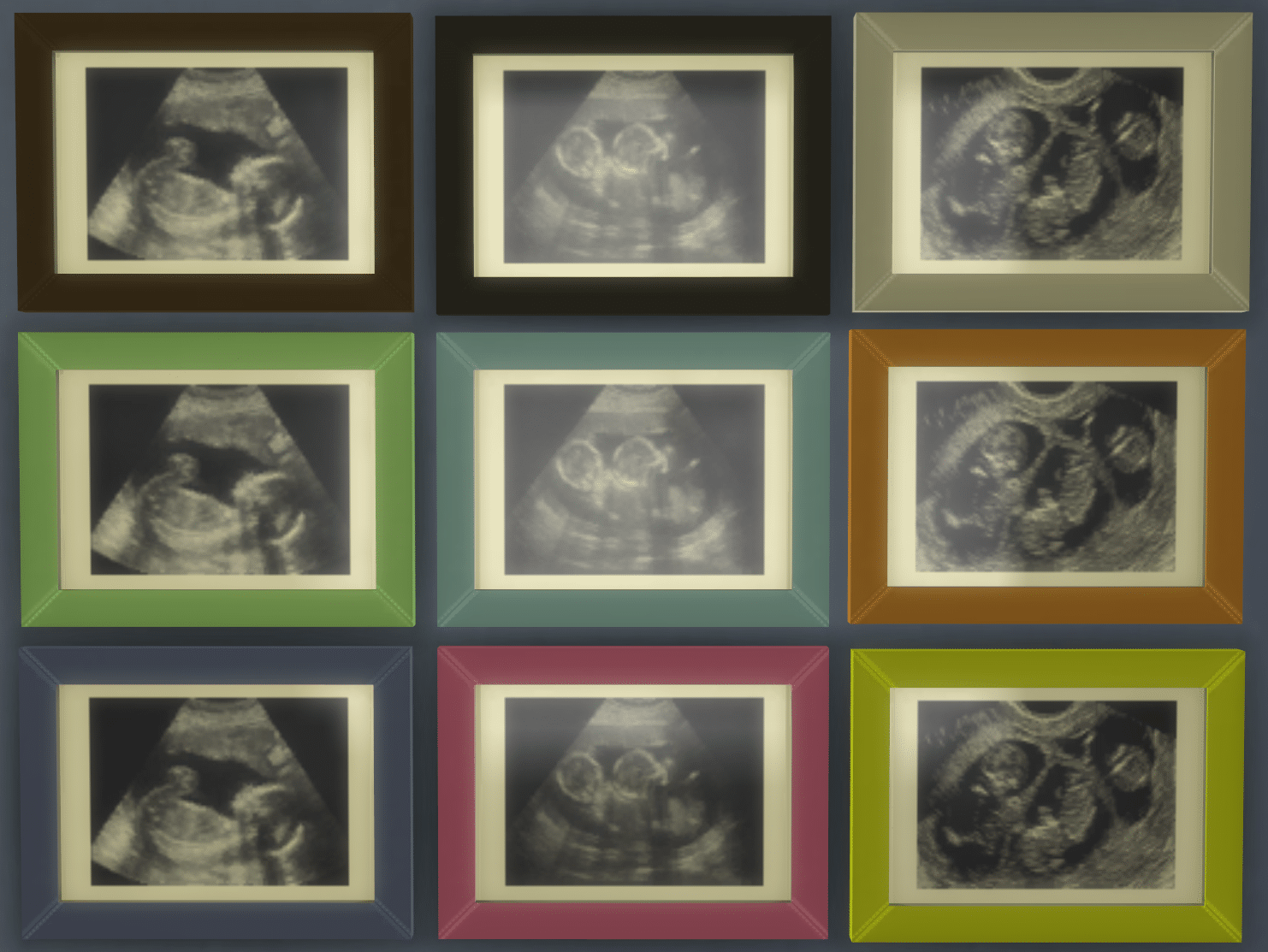 The Sims 4 Ultrasound Scan Mod: Know What To Expect When Expecting